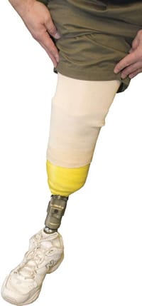 How to protect and care for prosthetic suspension sleeves – Amputee Store
