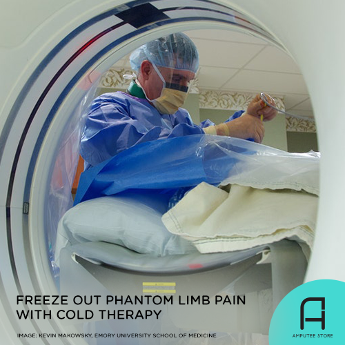 Freeze Out Phantom Limb Pain with Cold Therapy | Amputee Store