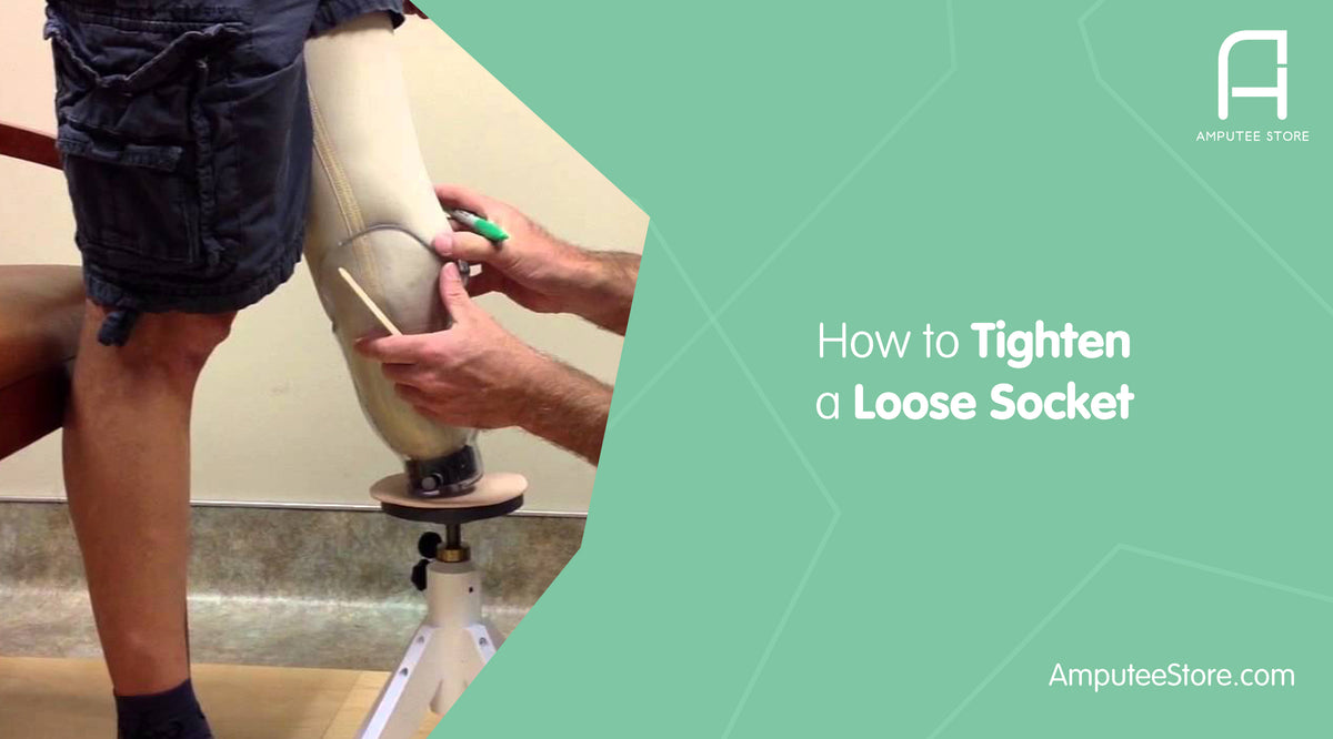 How to Tighten A Loose Prosthetic Socket | Amputee Store