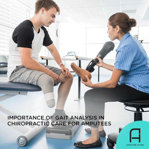 Gait Analysis in Chiropractic Care for Amputees | Amputee Store