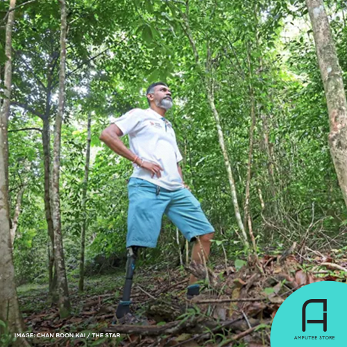 Man Lives Life to the Fullest After Losing Right Leg | Amputee Store