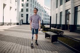 How do I deal with friction? | Prosthetic Personal Care Guide – Amputee ...
