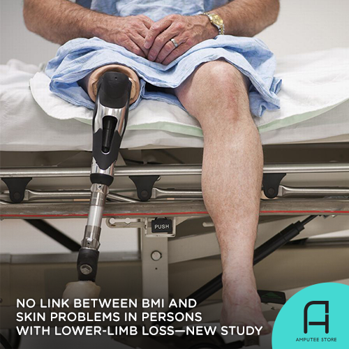 No Link in BMI, Skin Issues in Lower-Limb Amputees | Amputee Store