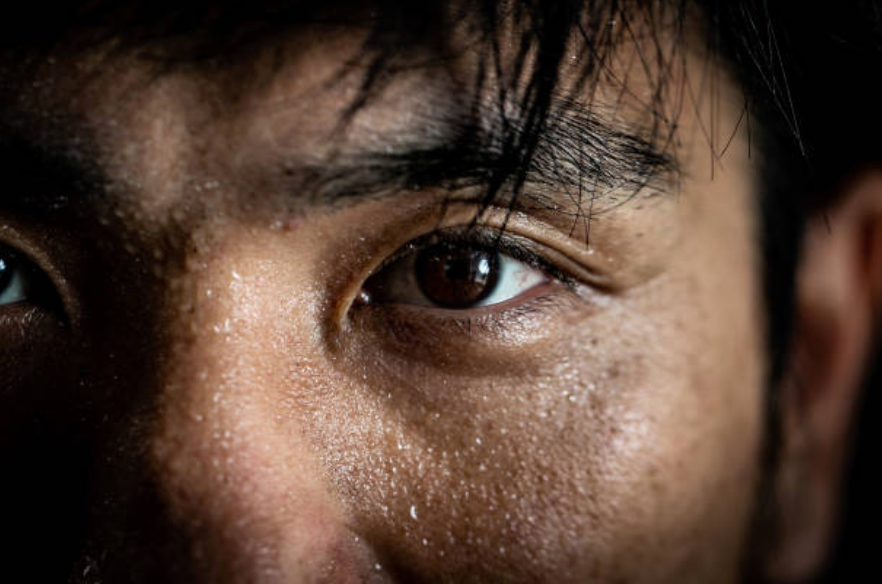 Outsmart Prothetic Sweat: How to Get Your Perspiration Under Control ...