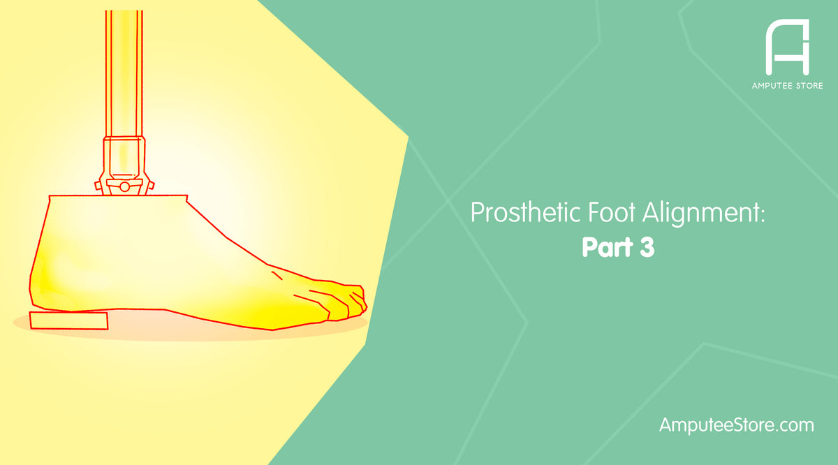 Prosthetic Foot Alignment: Rotation, Part 3 | Amputee Store