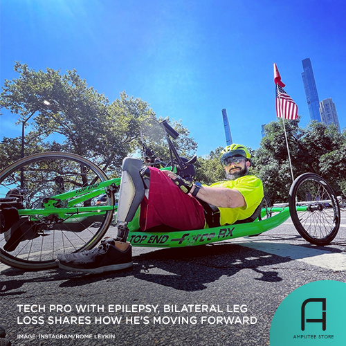 Tech Pro With Epilepsy, Bilateral Leg Loss Shares How He's Moving ...